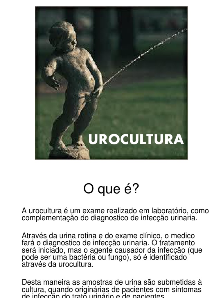 Urocultura Trabalho | PDF | Infecção do trato urinário | Especialidades ...