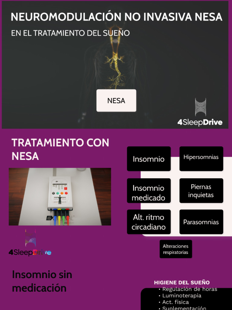 Tratamiento Con NESA Del Sueno | PDF
