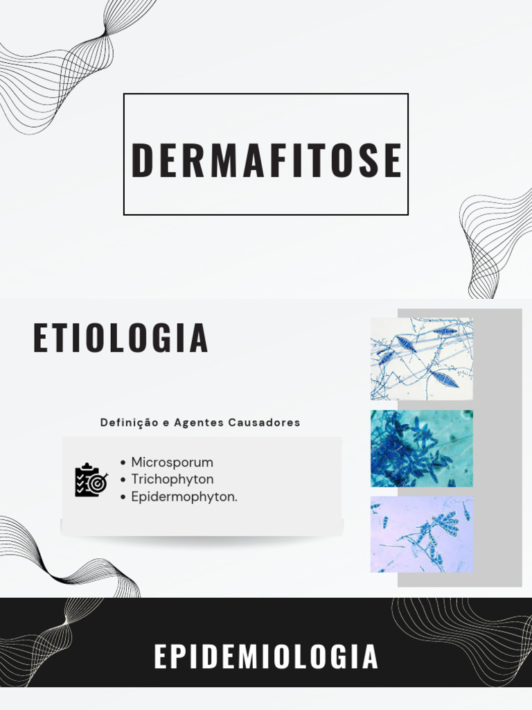 Dermatofitose | PDF