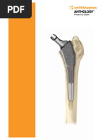 015 Exeter V40 Femoral Stem Using Modular Broach Surgical Technique For ...
