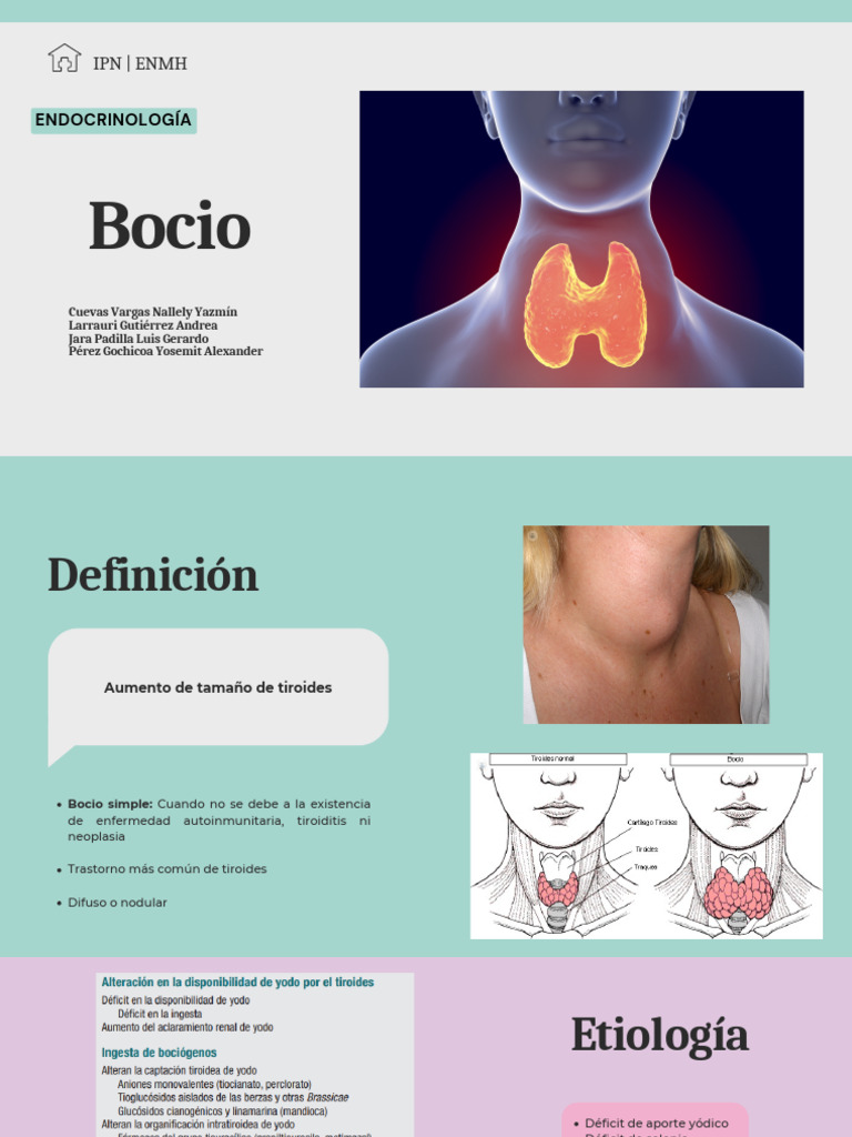 Bocio | PDF | Tiroides | Hipertiroidismo