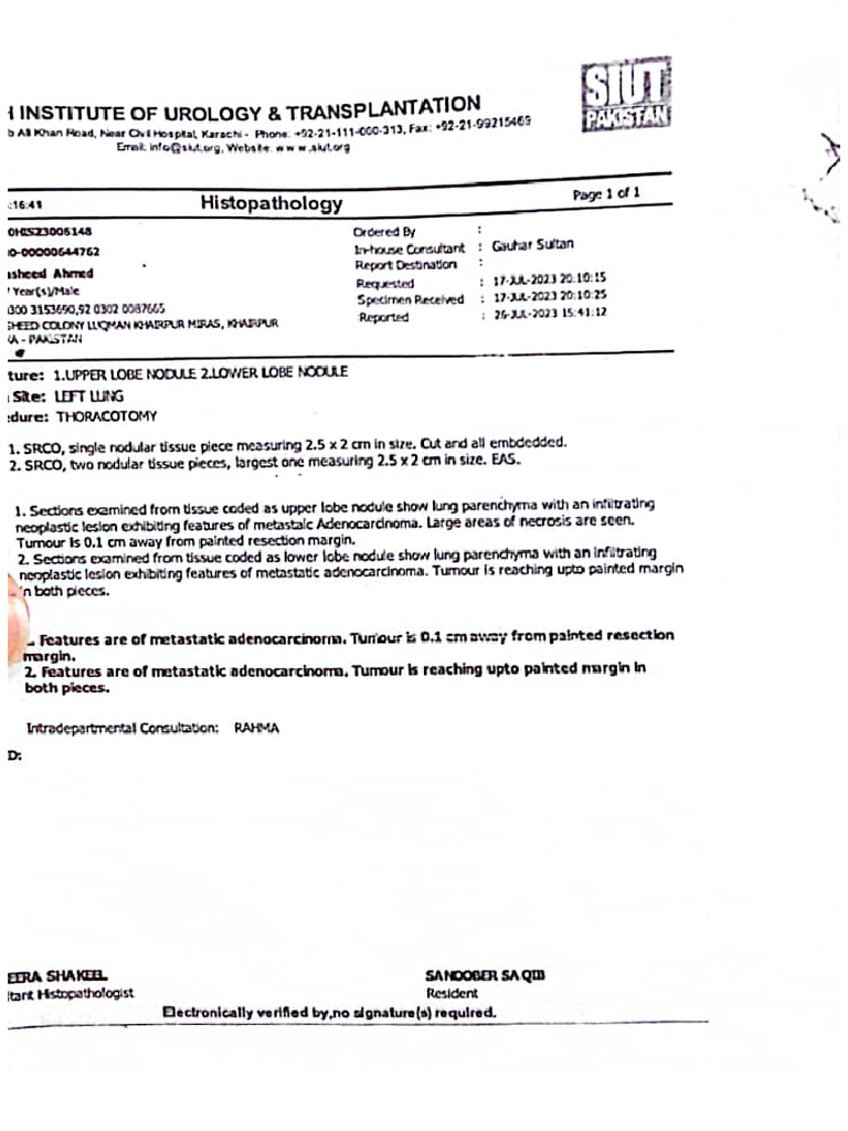 Biopsy of Nodule | PDF