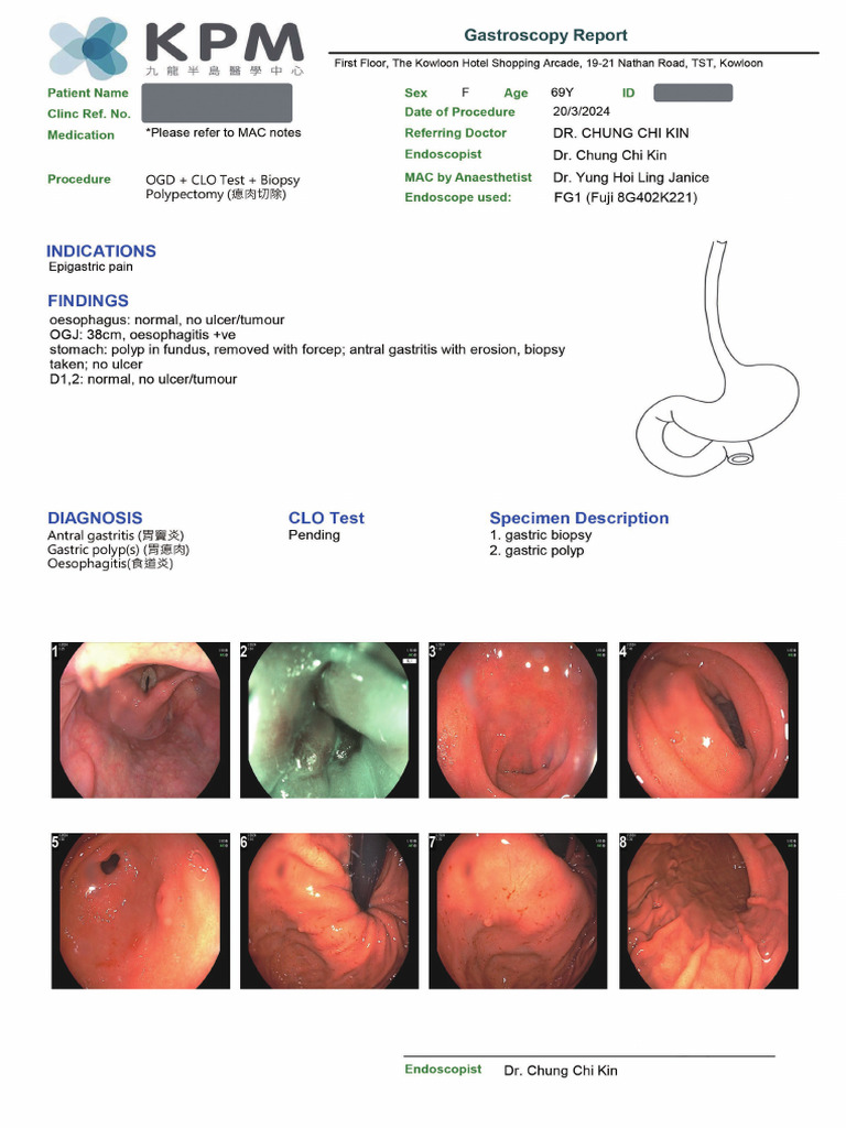 Fuji OGD Report Sample | PDF