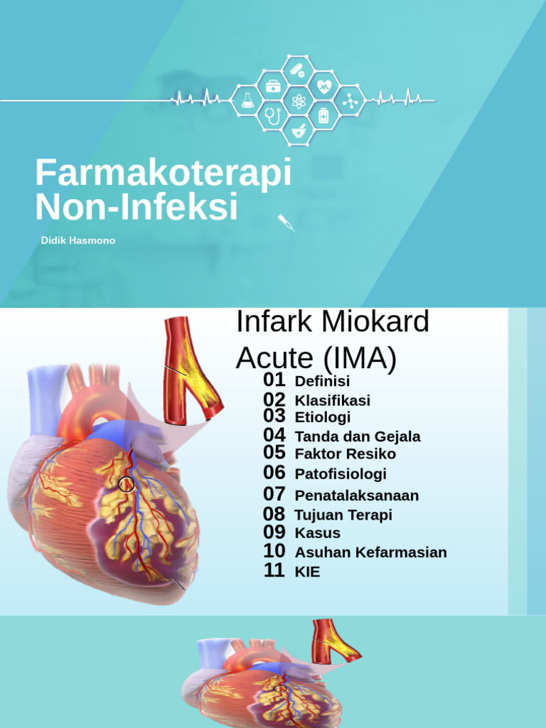 Infark Miokard Acute (IMA) New | PDF