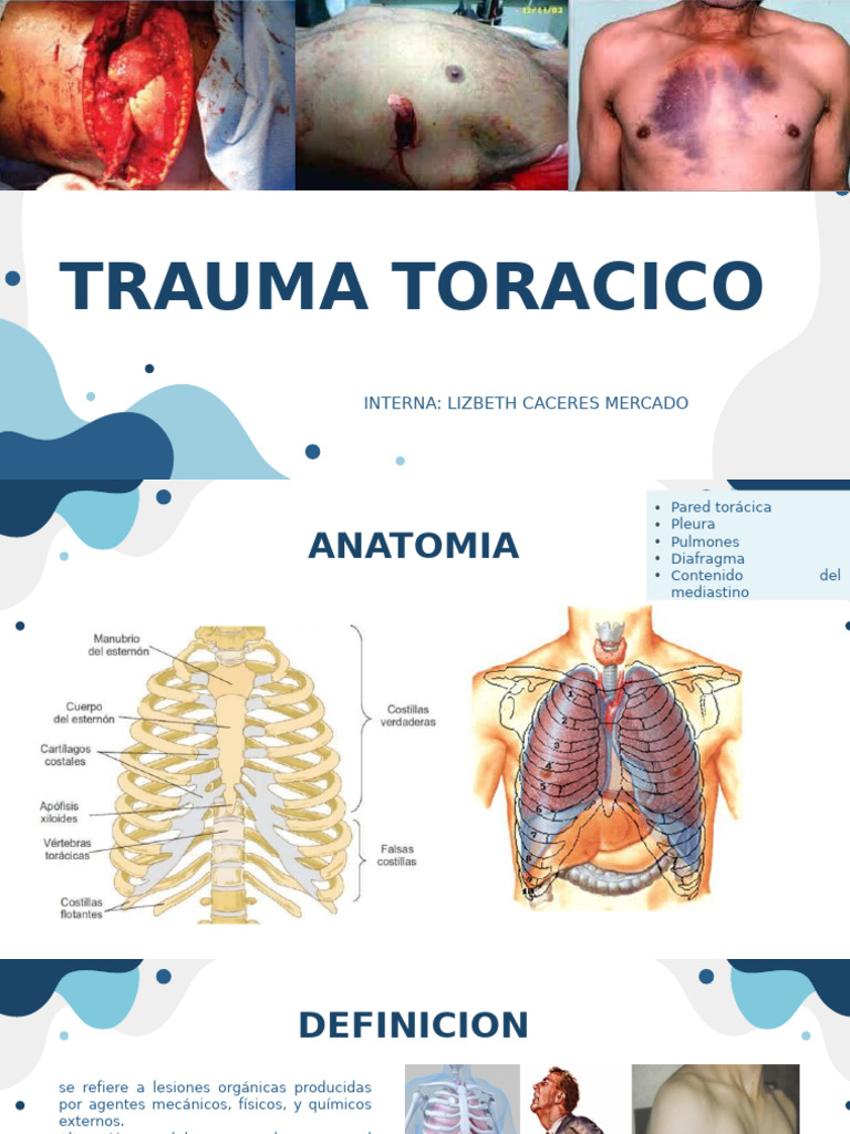 Trauma de Torax | PDF | Tórax (anatomía humana) | Emergencias Médicas
