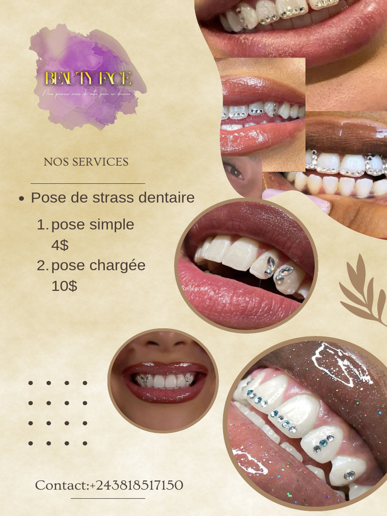 Strass Dentaire | PDF