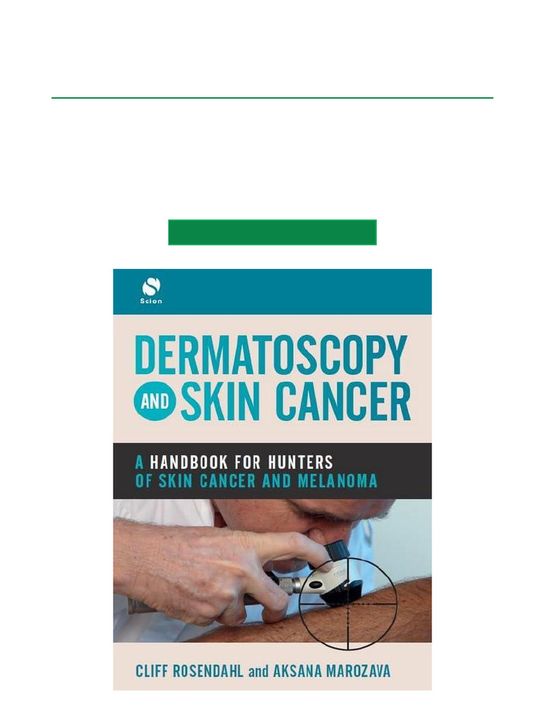 Dermatoscopy Handbook for Skin Cancer | PDF | Melanoma | Skin