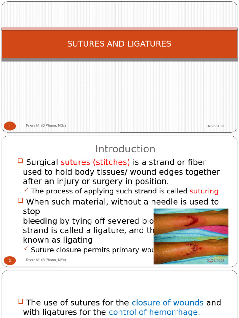 Part-II - Suture and Ligature | PDF | Surgical Suture | Syringe