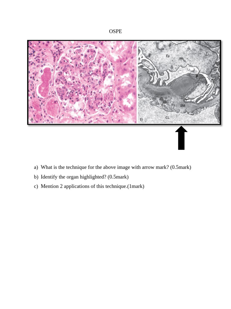 Electron Microscope | PDF