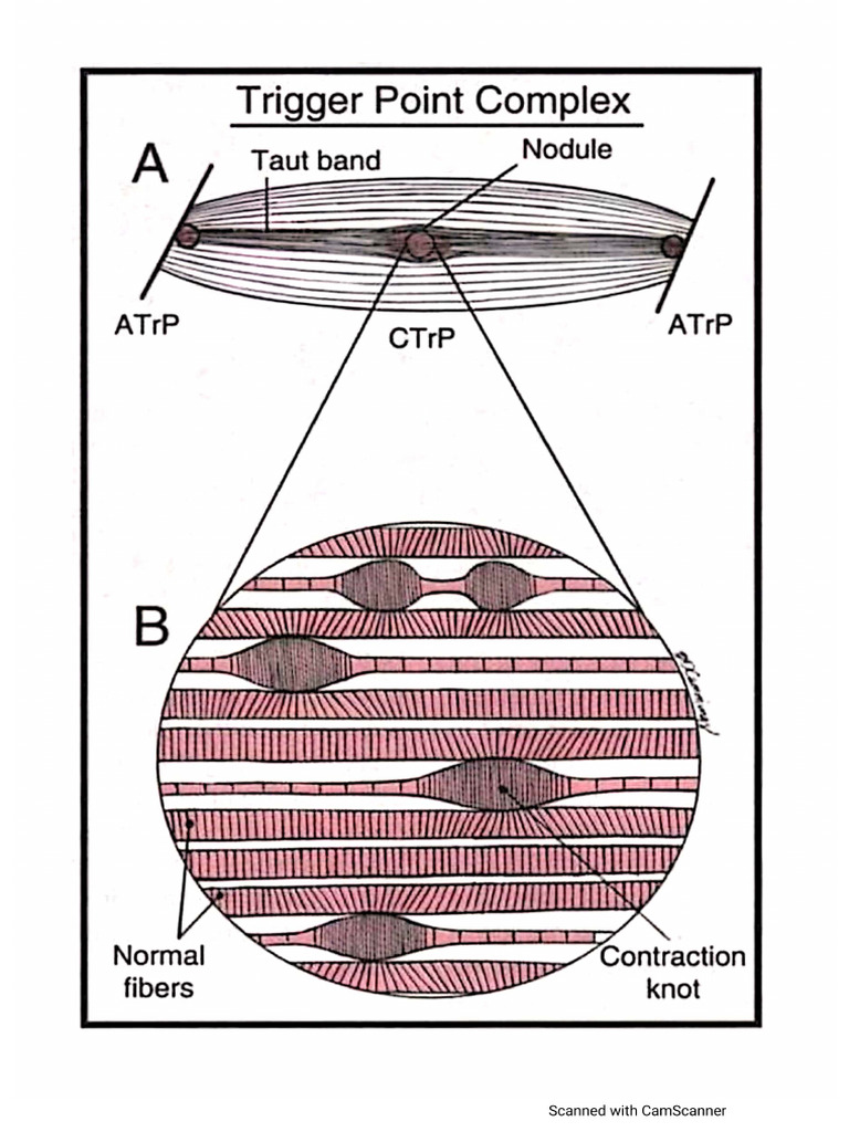 Triggerpoint Release | PDF
