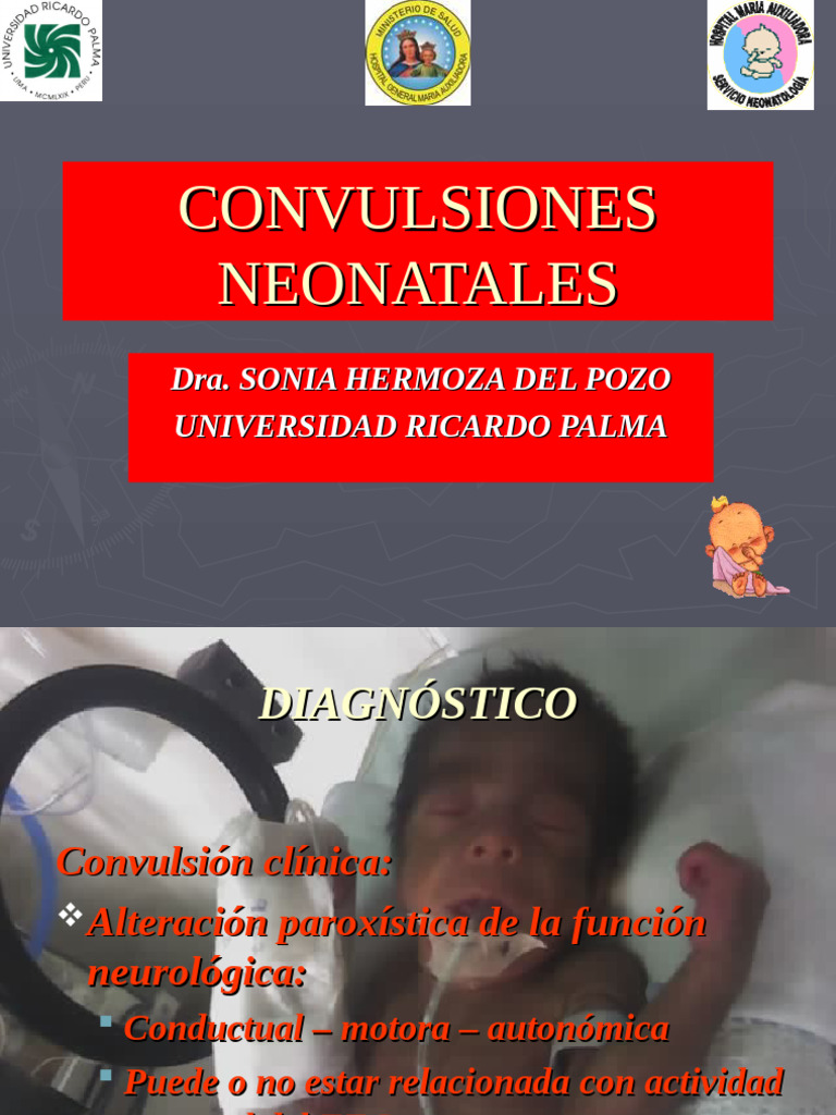 Convulsiones Neonatales | PDF | Meningitis | Epilepsia