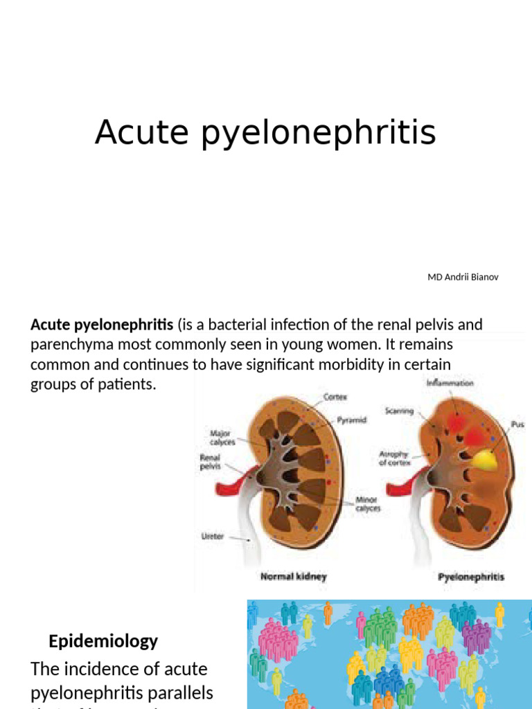 Acute Pyelonephritis Overview and Diagnosis | PDF | Medical Specialties ...