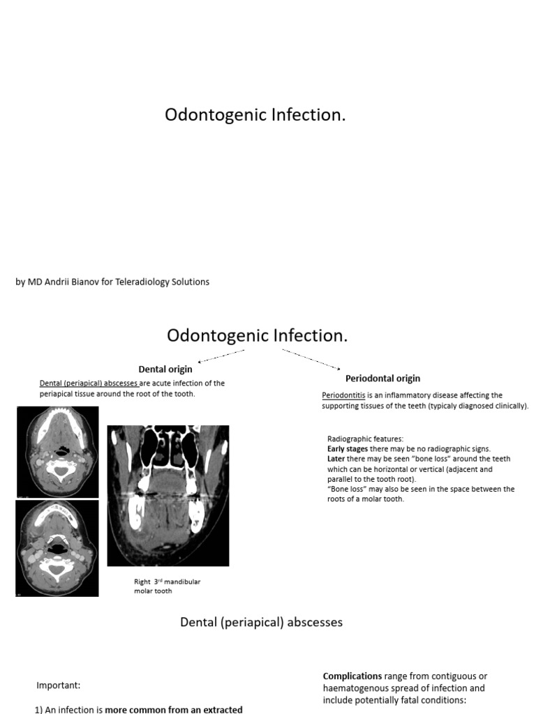 Odontogenic Infection by Dr Andrii Bianov | PDF | Dental Anatomy | Tooth