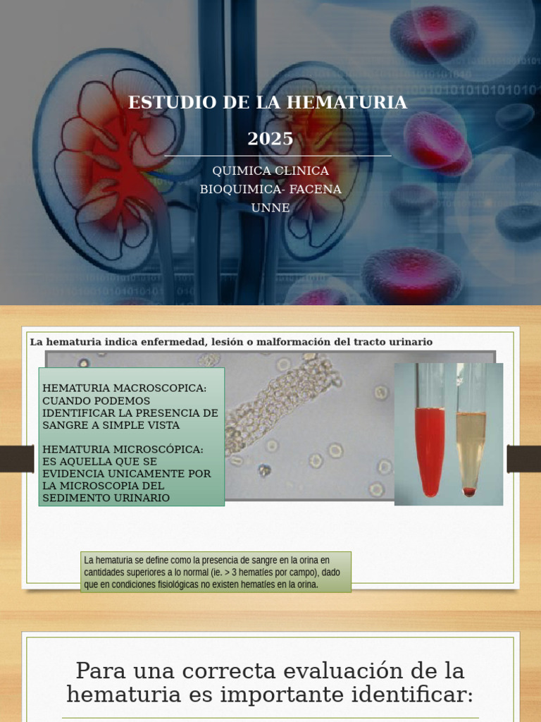 Estudio sobre Hematuria y su Diagnóstico | PDF | Medicina CLINICA ...