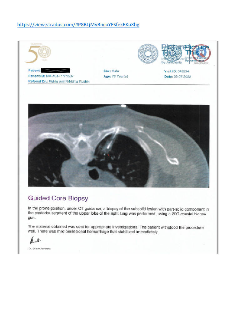 Biopsy Imaging | PDF