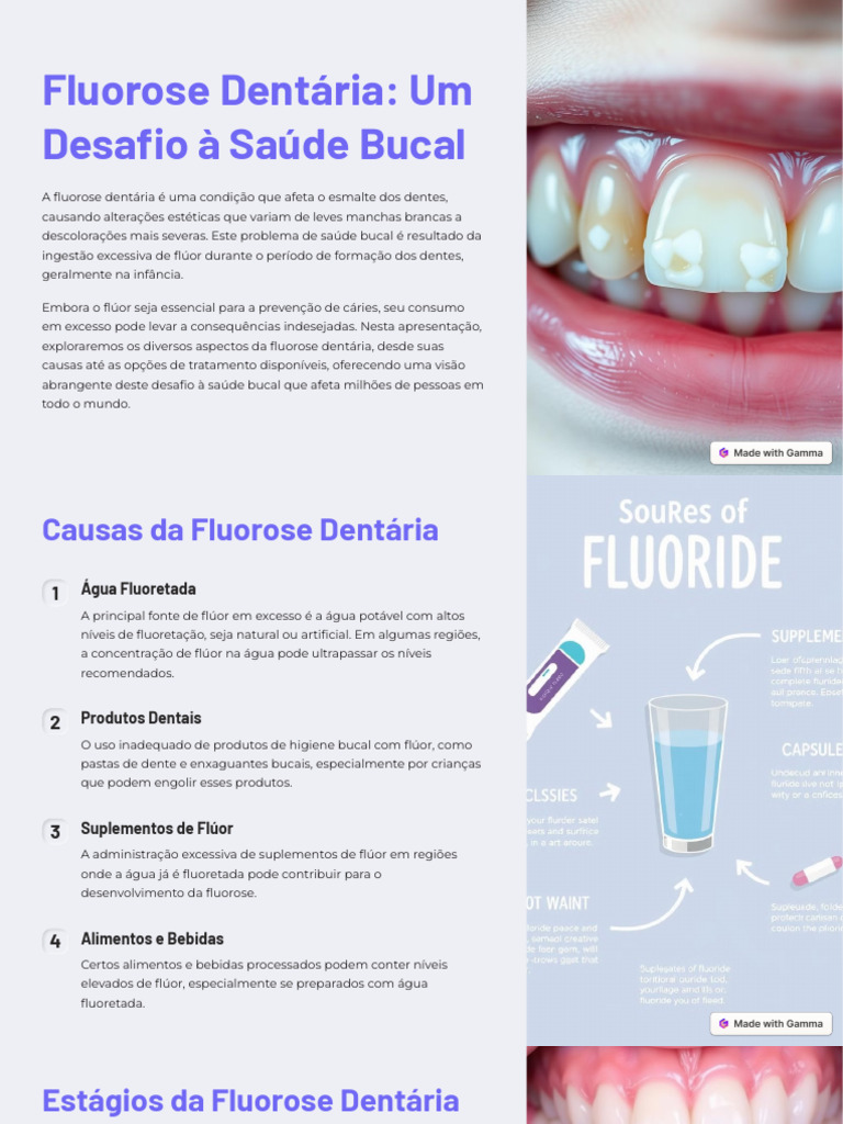 Fluorose Dentária: Causas e Tratamentos | PDF | Dente humano | Odontologia