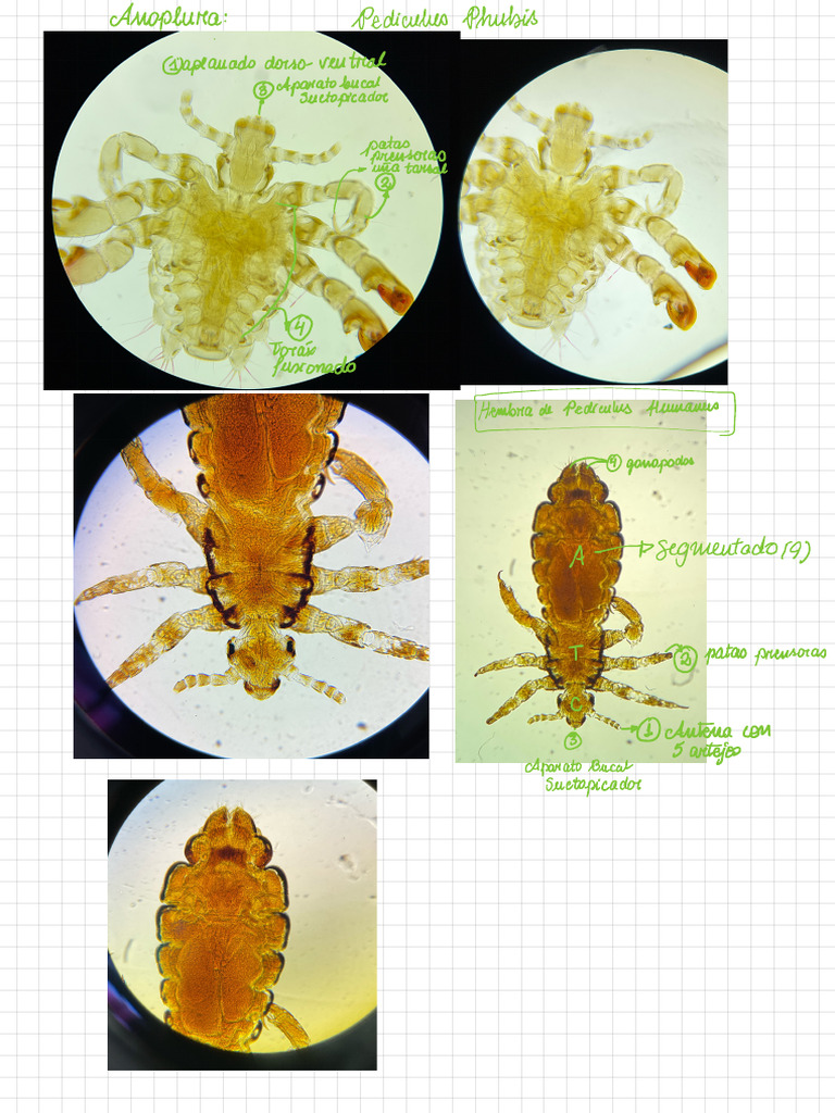 Anatomía y Clasificación de Insectos Parásitos | PDF | Insectos | Hexapoda