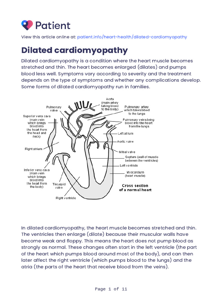 Understanding Dilated Cardiomyopathy | PDF | Artificial Cardiac ...