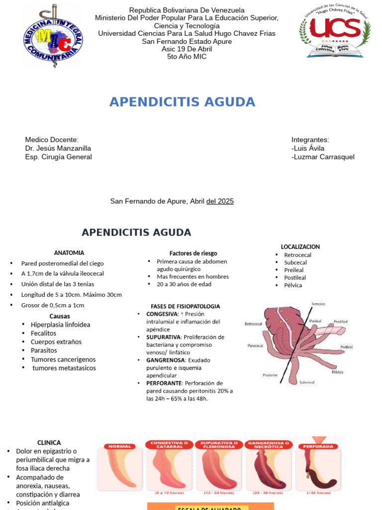 Apendicitis Aguda | PDF