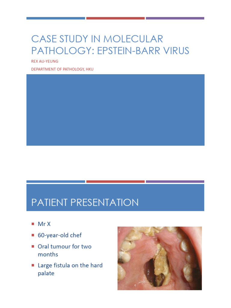 Case Study in Molecular Genetic Testing 2 (File 2) | PDF | Immunology ...