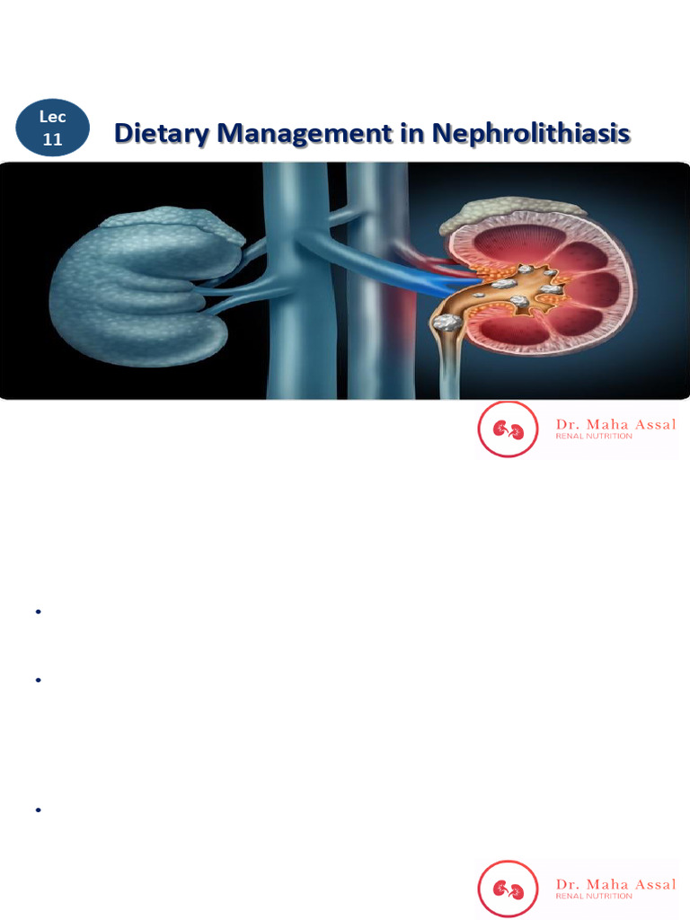 Lec 11, Dietary Management in Nephrolithiasis - 2IN1 | PDF | Urine | Gout