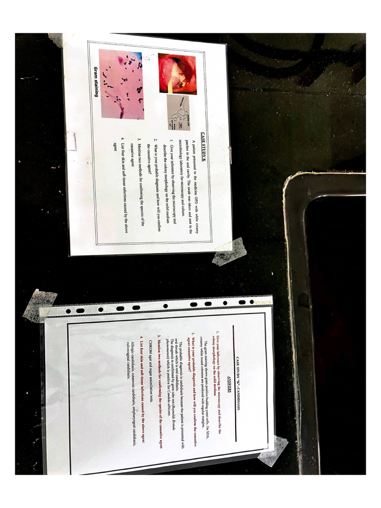 Micro Case Study | PDF