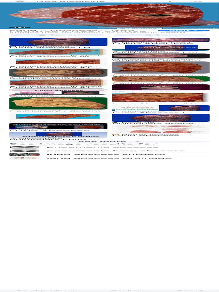 abscess pneumonia gross - | PDF