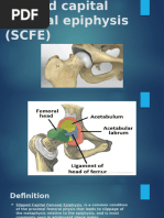 Drehmann Sign and Femoro Acetabular Impingement In.7 | PDF | Hip ...