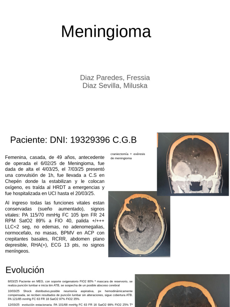 Manejo y tratamiento de meningioma | PDF | Desórdenes neurológicos ...