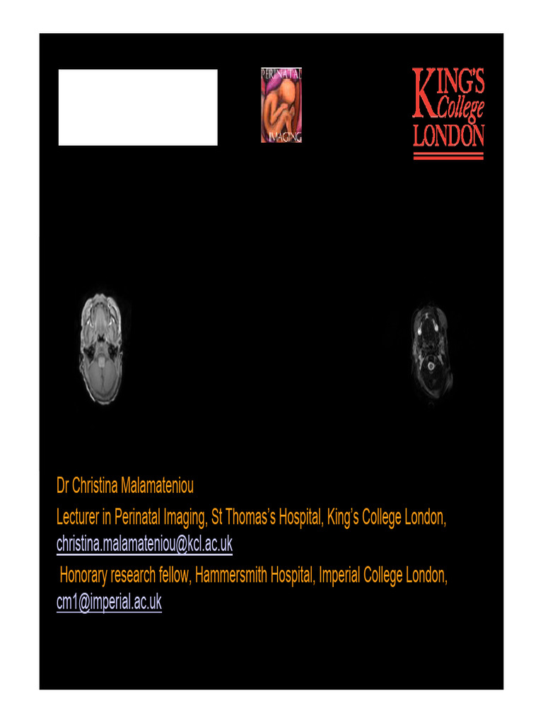 Neonatal MR Optimisation | PDF | Magnetic Resonance Imaging | Medical ...