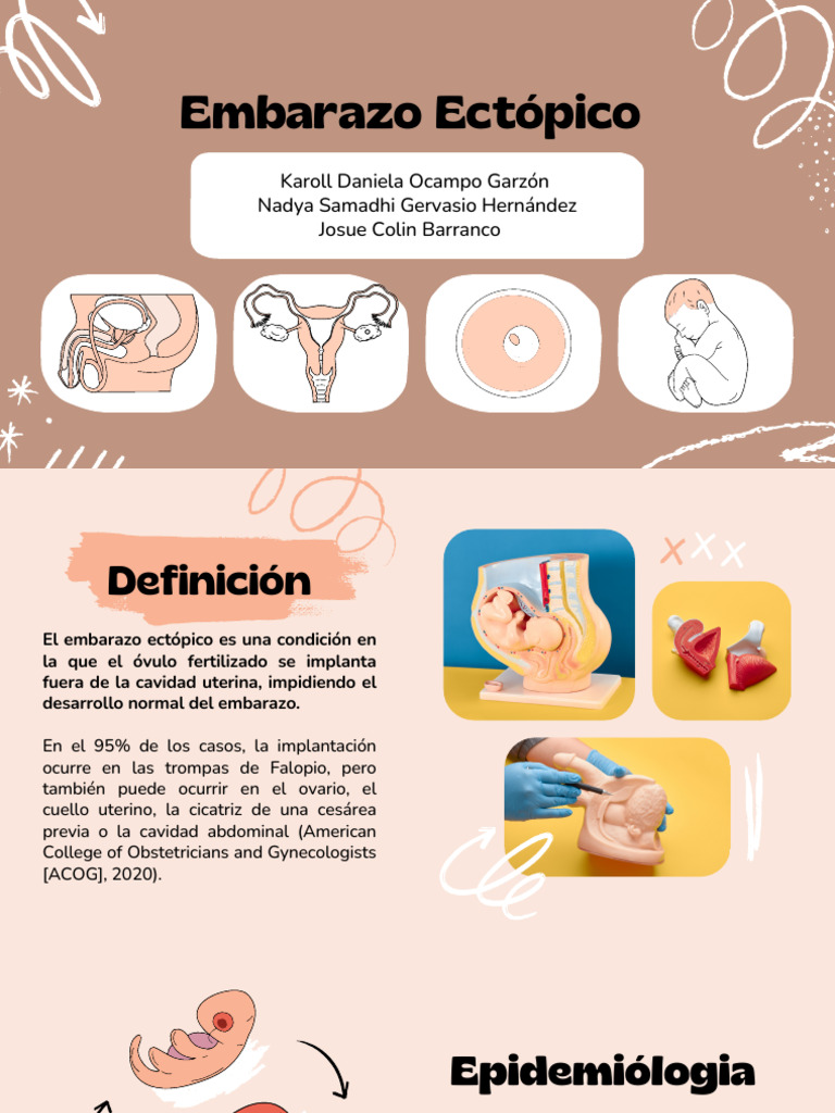 Embarazo Ectópico | PDF | El embarazo | Medicina CLINICA