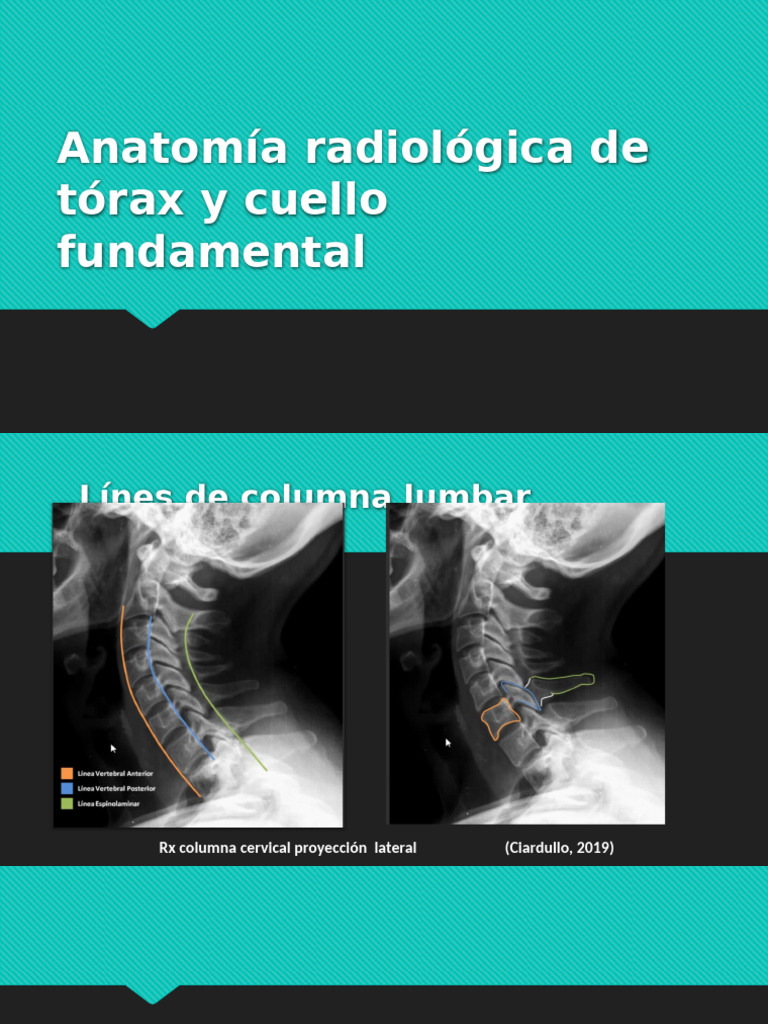 Anatomía Radiológica de Tórax y Cuello | PDF