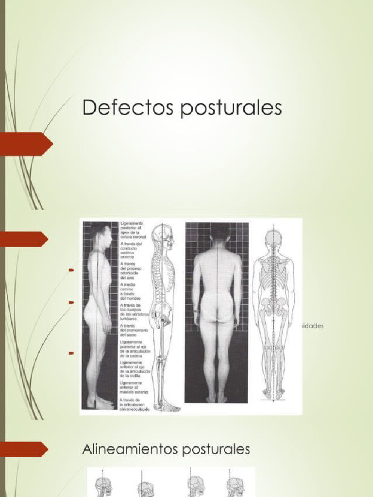 Defectos Posturales Completo | PDF