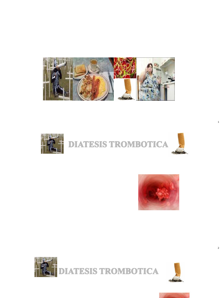 20 Trombosis y diagnostico de la diatesis trombotica | PDF | Trombo ...