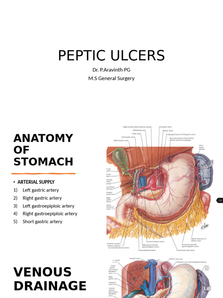 Presentation Peptic Ulcer | PDF | Stomach | Digestive System