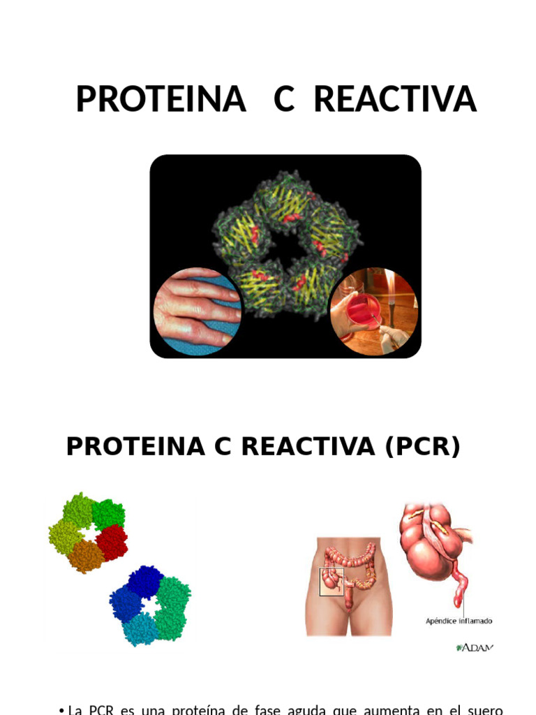 Pruebas de RPR, PCR, ASO Y FR | PDF | Inflamación | Proteína C-reactiva