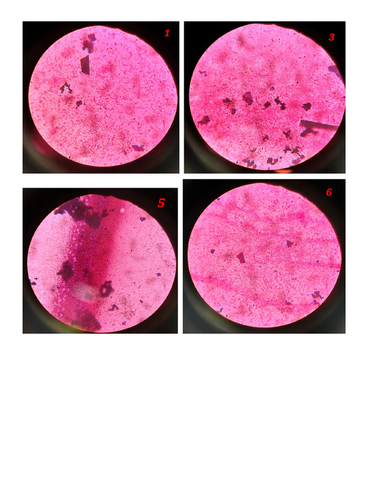 Gram Staining | PDF