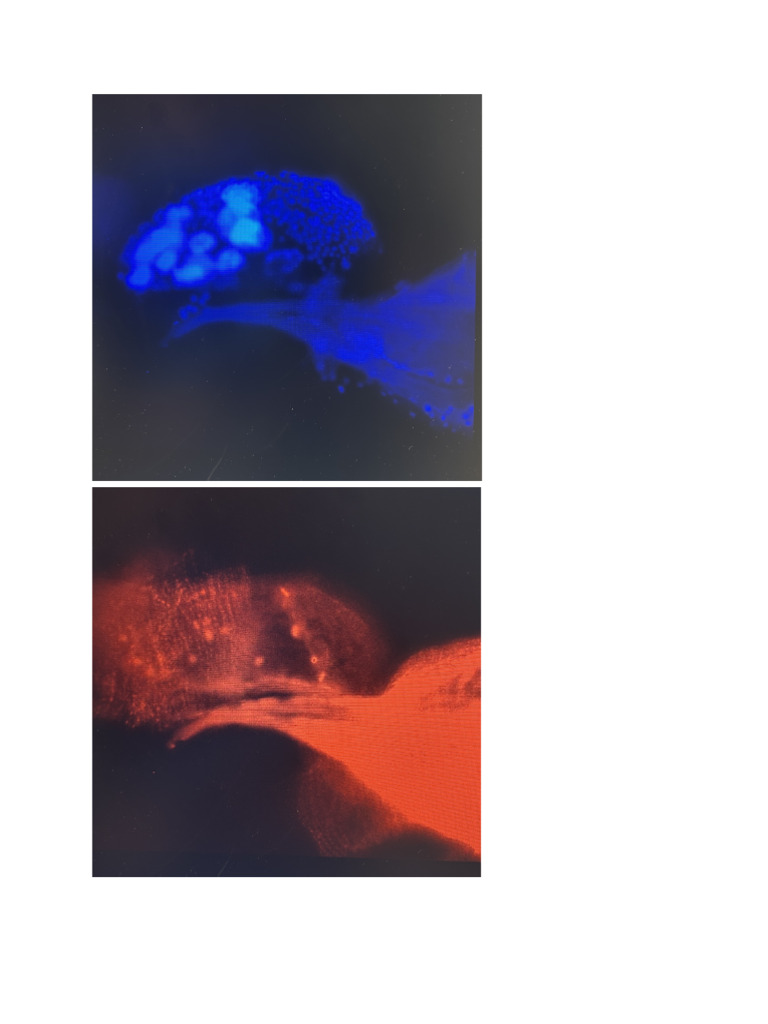 BIO 211 - Experiment 2 Lab 3 Stain Pictures | PDF