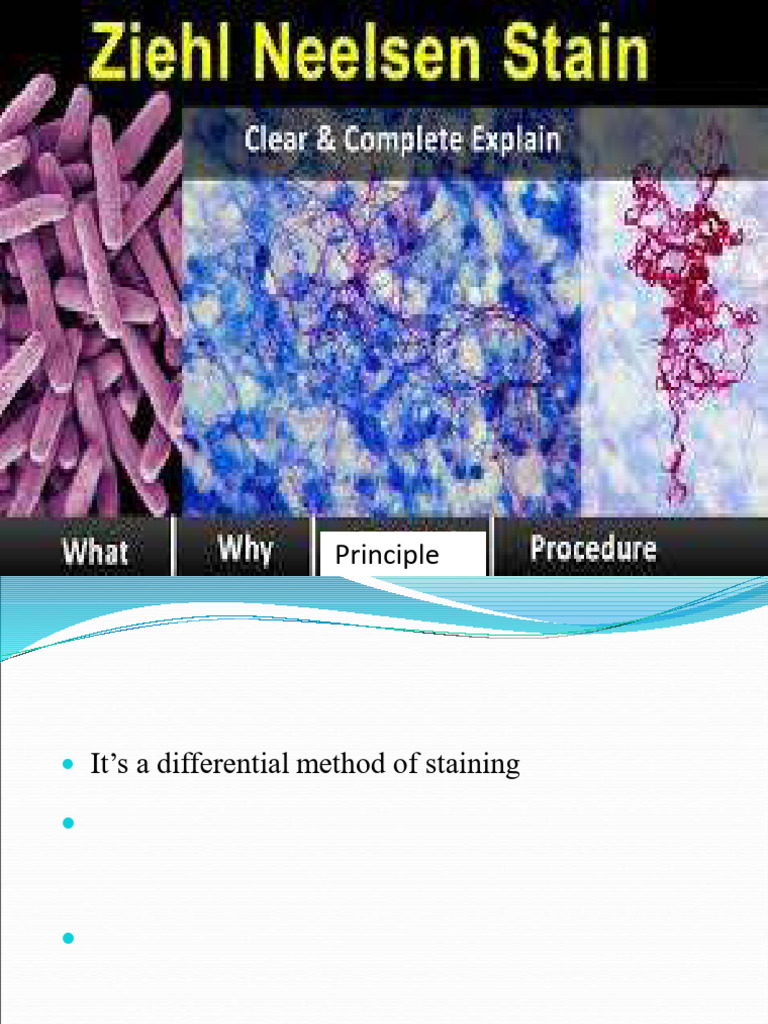 Acid Fast Staining Theory and Demo | PDF | Staining | Microscopy