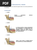 Clasificación de Terceros Molares | PDF