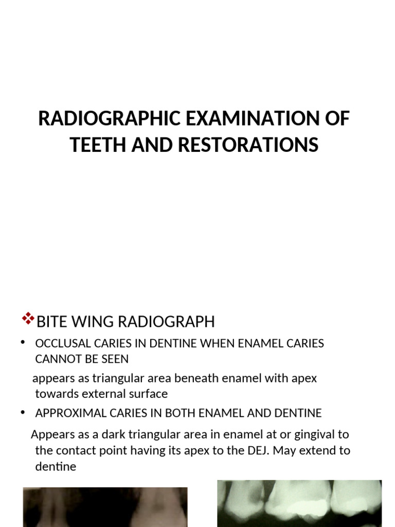 Last Lec Exam of Occlusion Perio Radio Adj Tests | PDF | Dental Anatomy ...