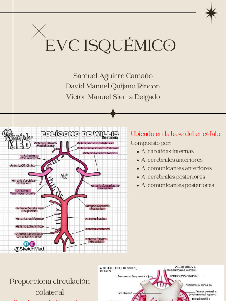 EVC Isquémico | PDF | Carrera | Isquemia