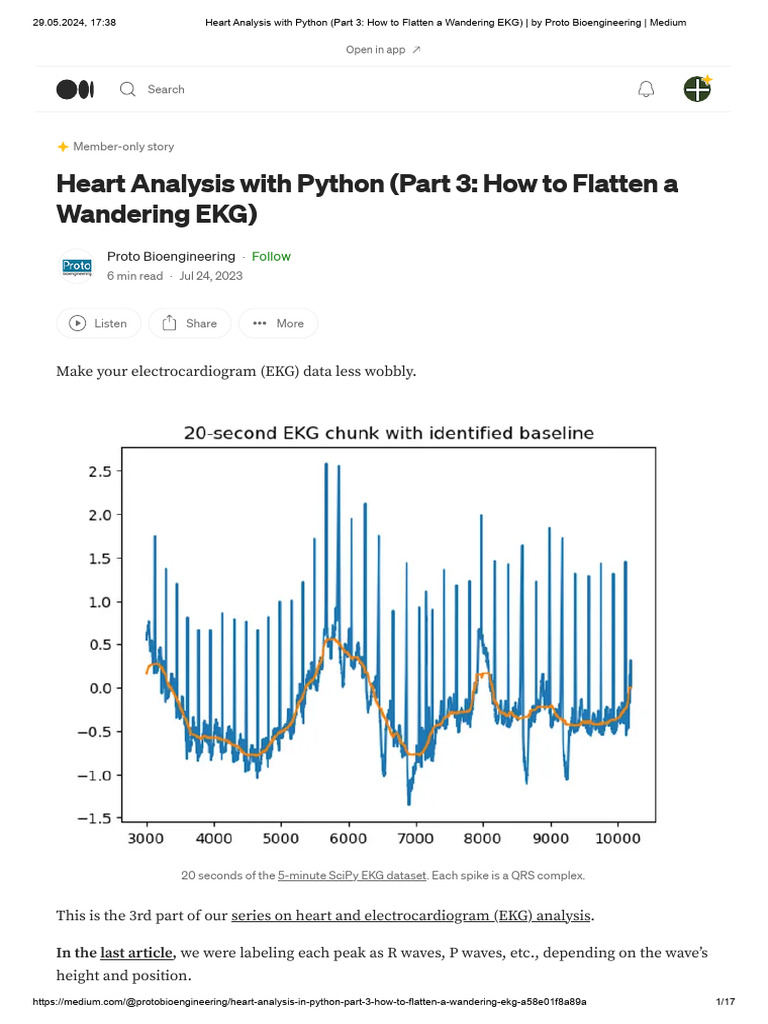 Heart Analysis With Python (Part 3 - How To Flatten A Wandering EKG) - by Proto Bioengineering ...