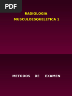 Osteofitos y su Impacto Clínico | PDF | Hueso | Sistema musculoesquelético