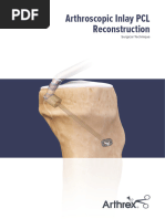 AC Joint Repair Arthrex | PDF | Surgical Suture | Joints