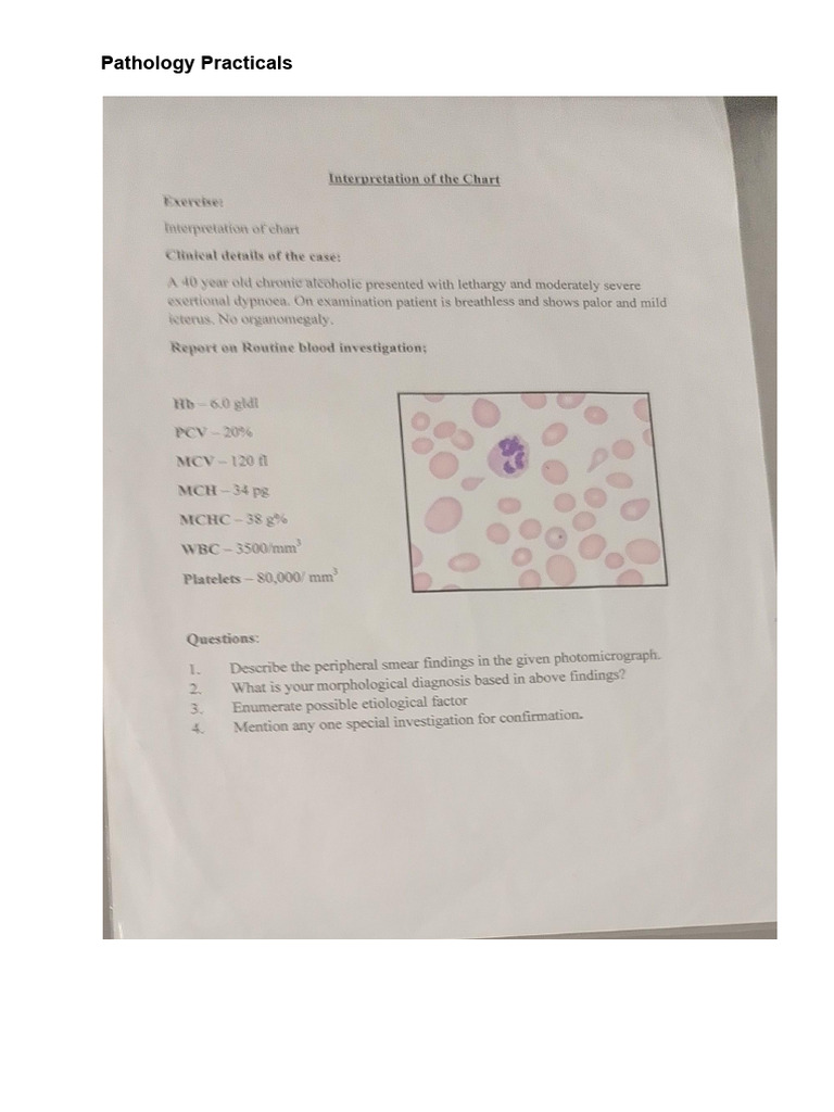 Hematology Clinical charts 1No's (1Ã_5=5 marks) | PDF | Anemia | Lymphocyte