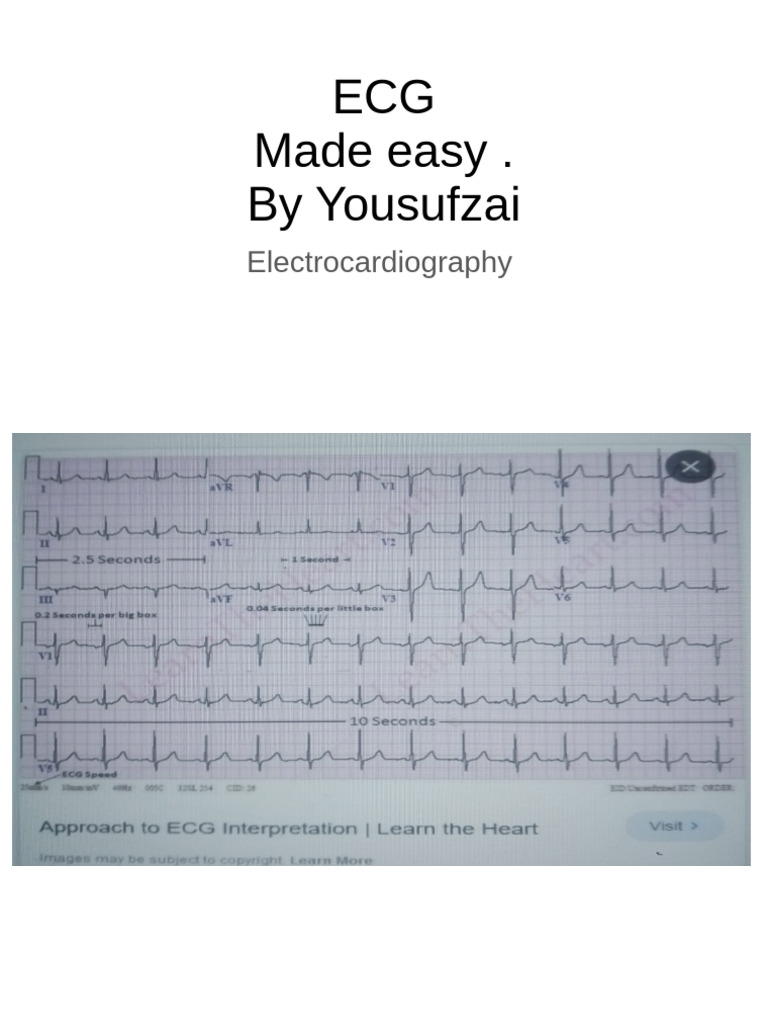 ECG Presentation | PDF