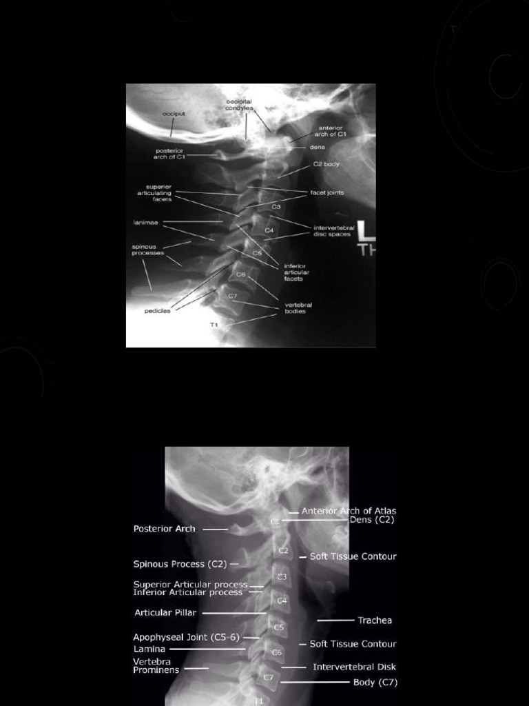ANATOMY - BACK, SPINE, PRACTICE SLIDES (Compiled) | PDF