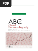 Delta Wave - LITFL Medical Blog - ECG Library Basics | PDF | Cardiac ...