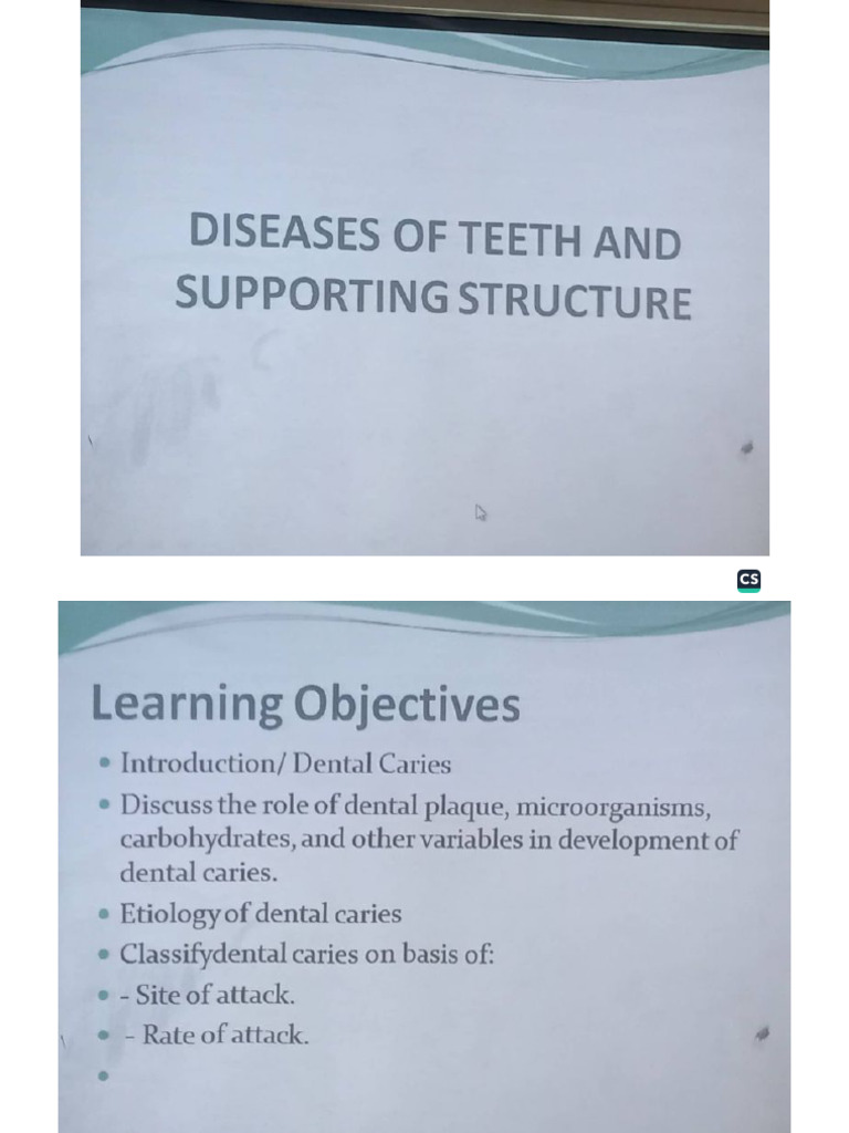 Dental Caries Oral Patho | PDF